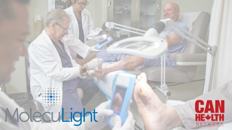 Novel Technology to Help Improve Wound Care in Canada Enabled Through ...