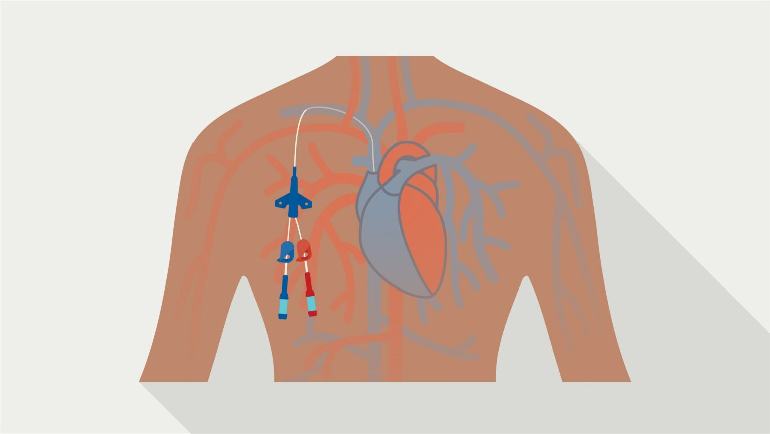 Catheter Lock Solutions - CAN Health